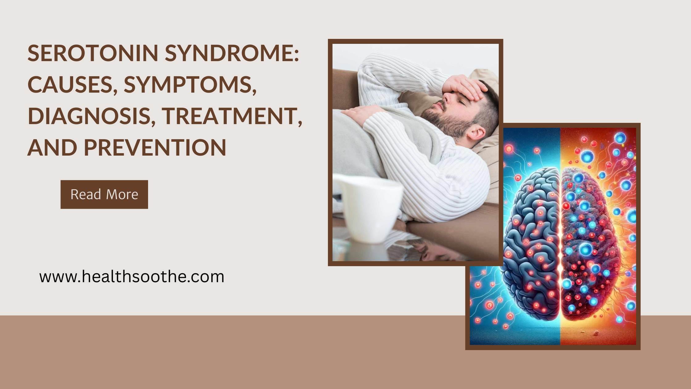 Serotonin Syndrome: Causes, Symptoms, Diagnosis, Treatment, And Prevention